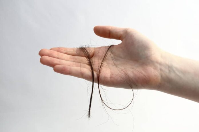 el trastorno en el que hay una carencia invicto de arrancarse el pelo ...