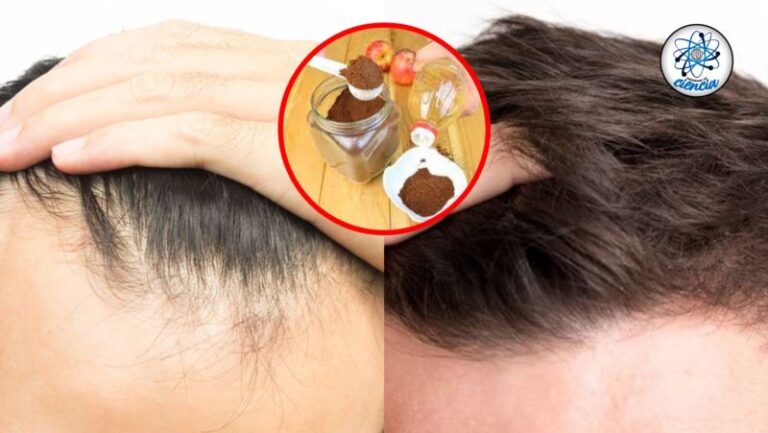 Descubre estos 3 poderosos ingredientes para aprestar su aparición y ...